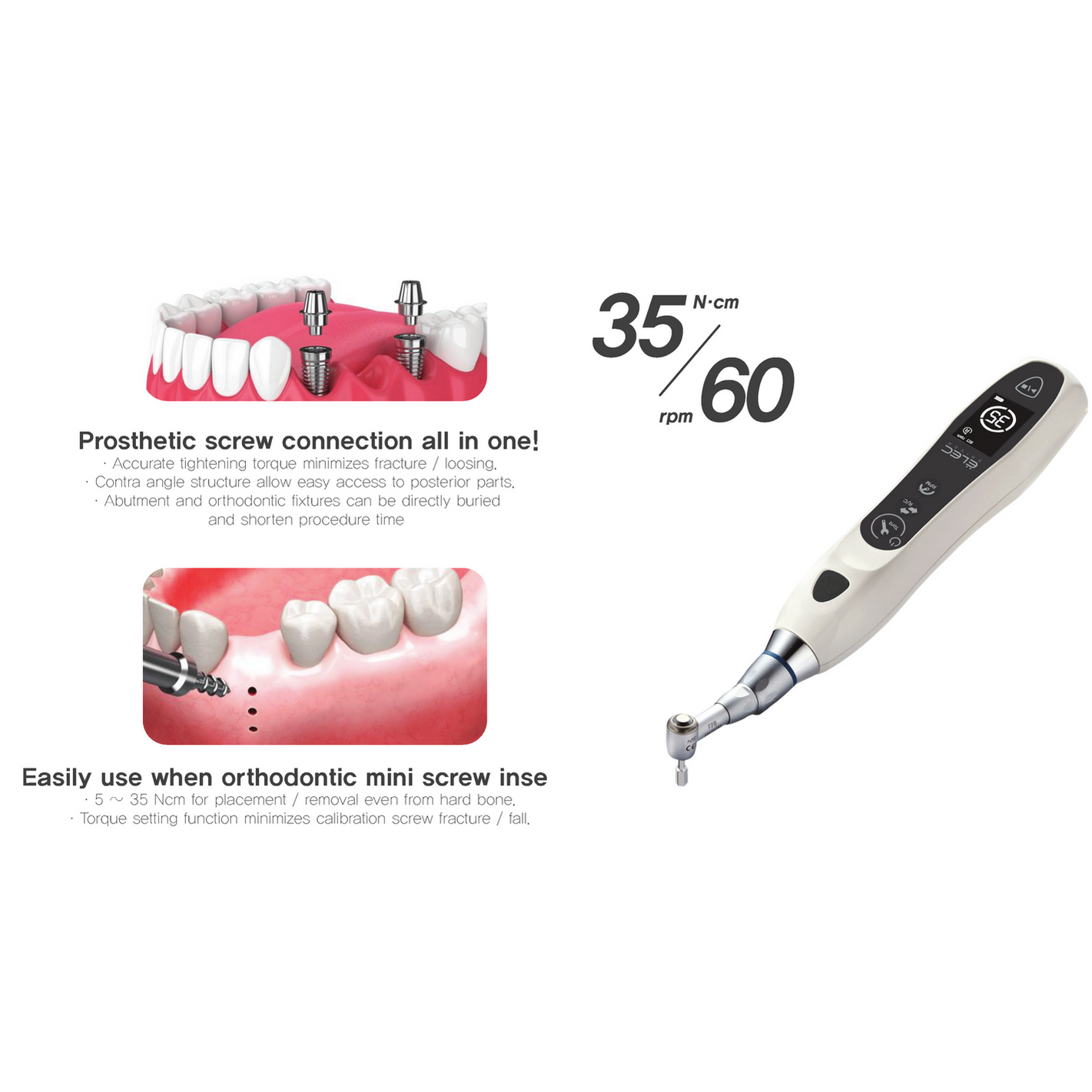 Electric Wireless Torque Driver | Avtec Dental
